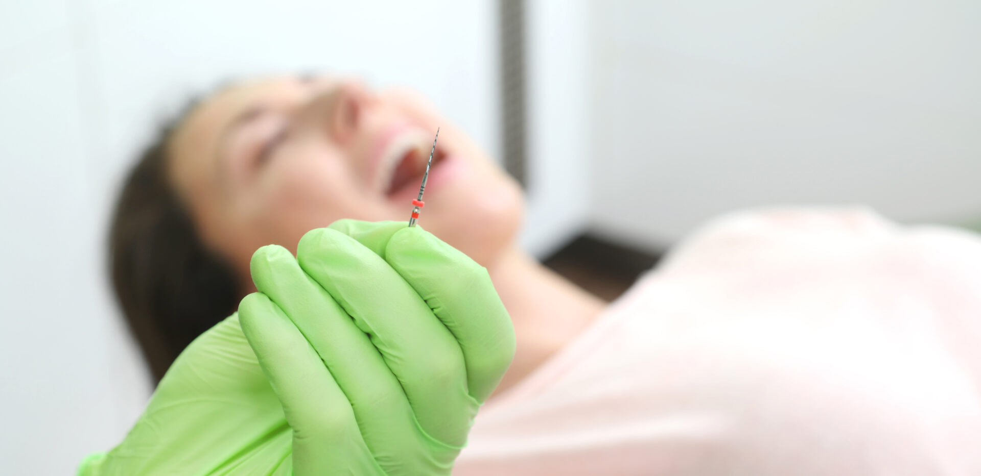 Endodontie/Wurzelbehandlung - Zahnarzt Dr. Vogt